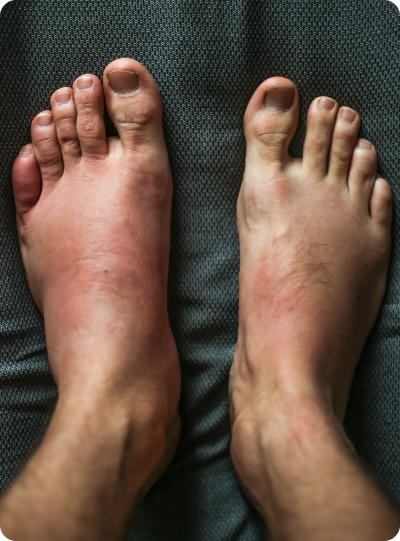 Pain Relief Cream | Arthritis, Inflammation, Muscle Pain | Mega Aid