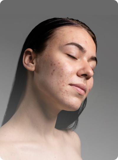 Dermatology medical solutions | Acne | Dry Skin | Psoriasis | Eczema ...