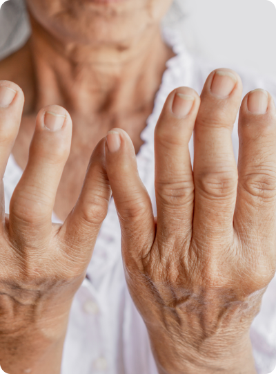 Pain Relief Cream | Arthritis, Inflammation, Muscle Pain | Mega Aid