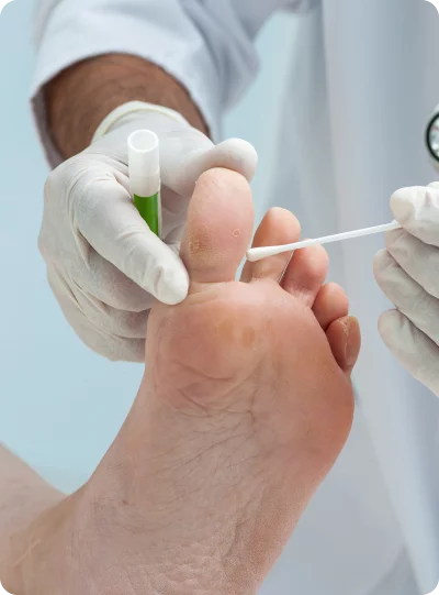 Nail Fungus Treatment | Skin Fungus Treatment | Mega Aid